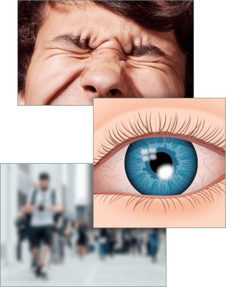 Corneal Infections | NorthEast Ohio Eye Surgeons