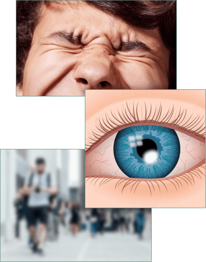 Corneal Infections | NorthEast Ohio Eye Surgeons